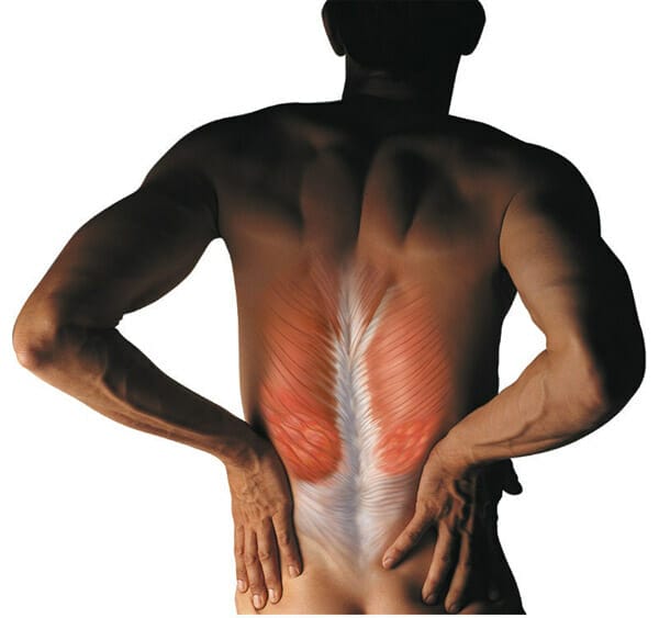 Muscle Spasms: Back Muscle Spasms - RespectCareGivers