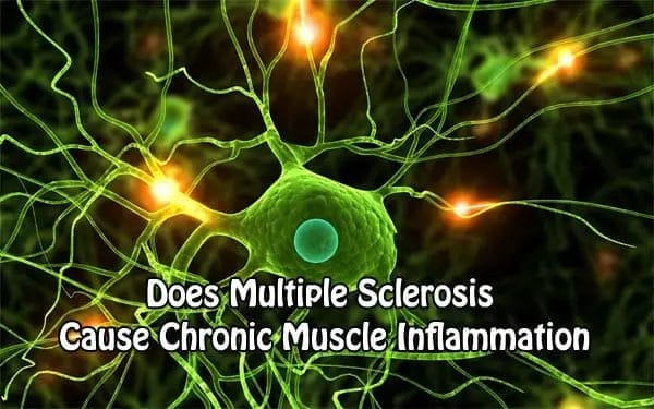 Does Multiple Sclerosis Cause Chronic Muscle Inflammation ...