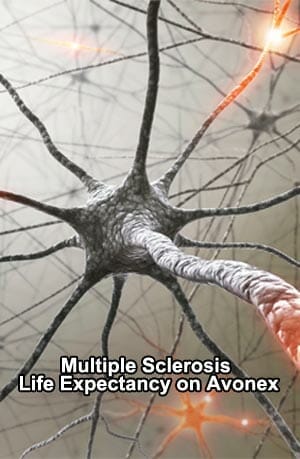 Multiple Sclerosis Life Expectancy on Avonex - RespectCareGivers