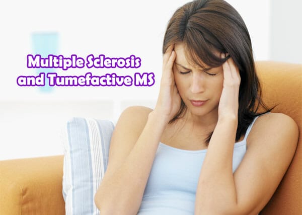 Multiple Sclerosis And Tumefactive Ms Respectcaregivers
