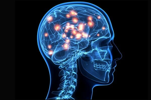 Everything You Need to Know about Fibromyalgia’s Neurological Nature ...