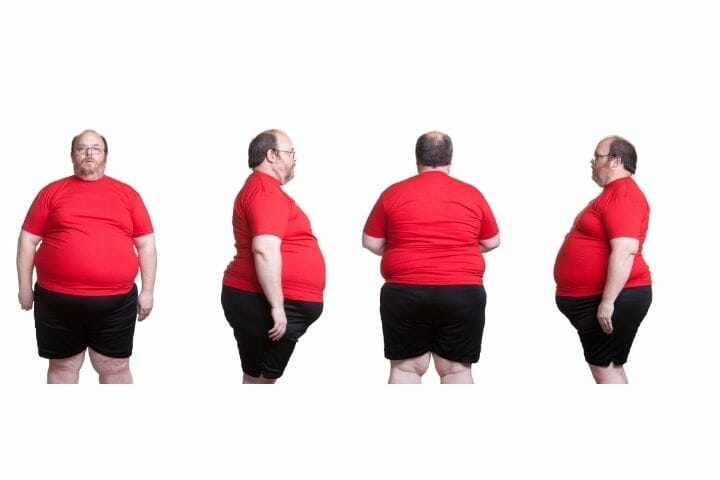 The Impact Of Rising Obesity On Seniors And Caregivers - RespectCareGivers