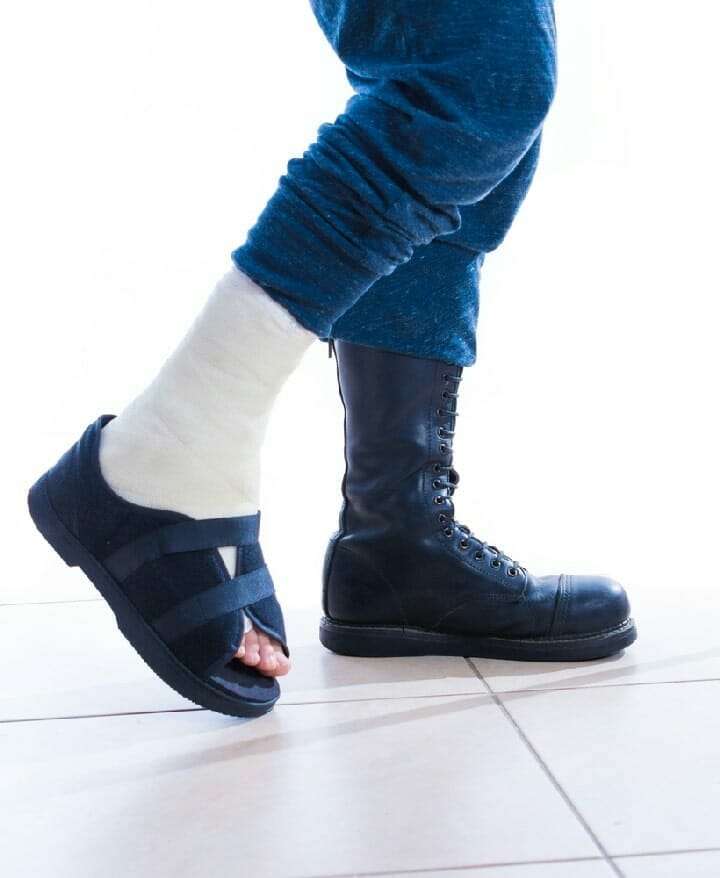 Best Walking Boot Cast - RespectCareGivers Best Walking Boot Cast - RespectCareGivers